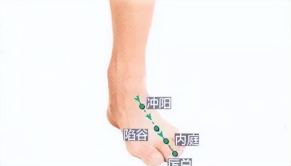 Acupuncture and moxibustion treat "all kinds of headaches" special ...