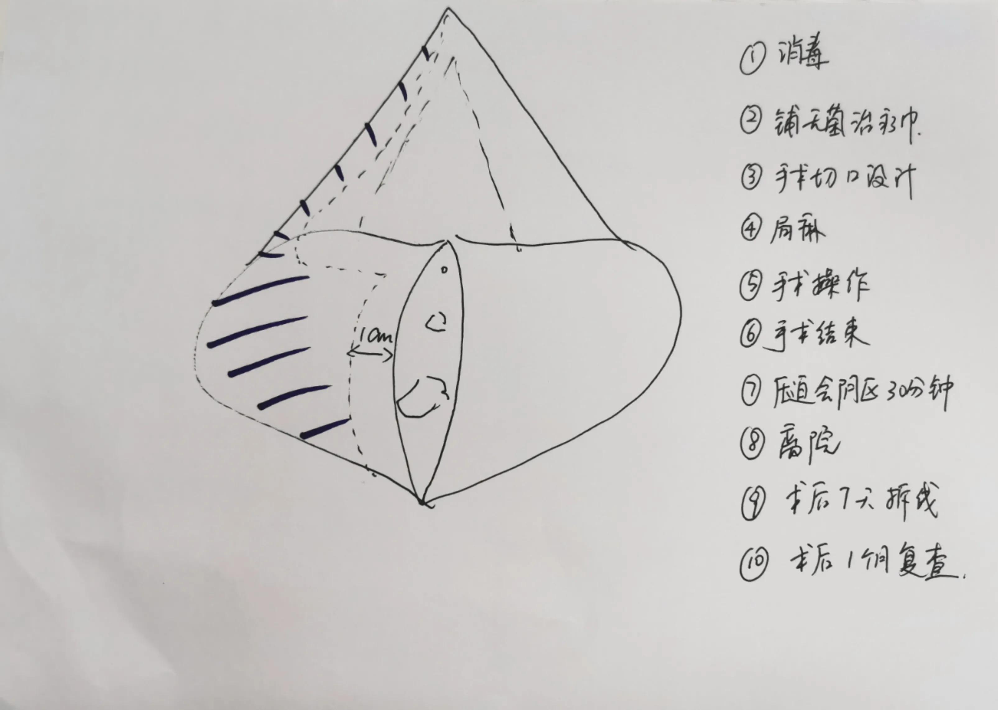 Detailed introduction to the whole process of private labia minora ...