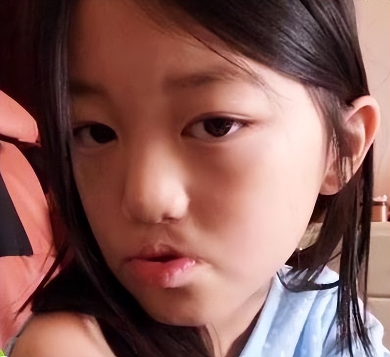 Faye Wong's daughter Li Yan and Feng Xiaogang's daughter Feng Siyu also suffer from cleft lip ...