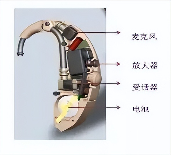 What is the principle of hearing aids? - iNEWS