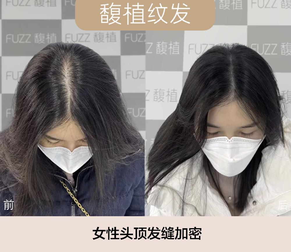 If you want to learn hair tattoo skills, go to Fu Zhi Hair Tattoo ...