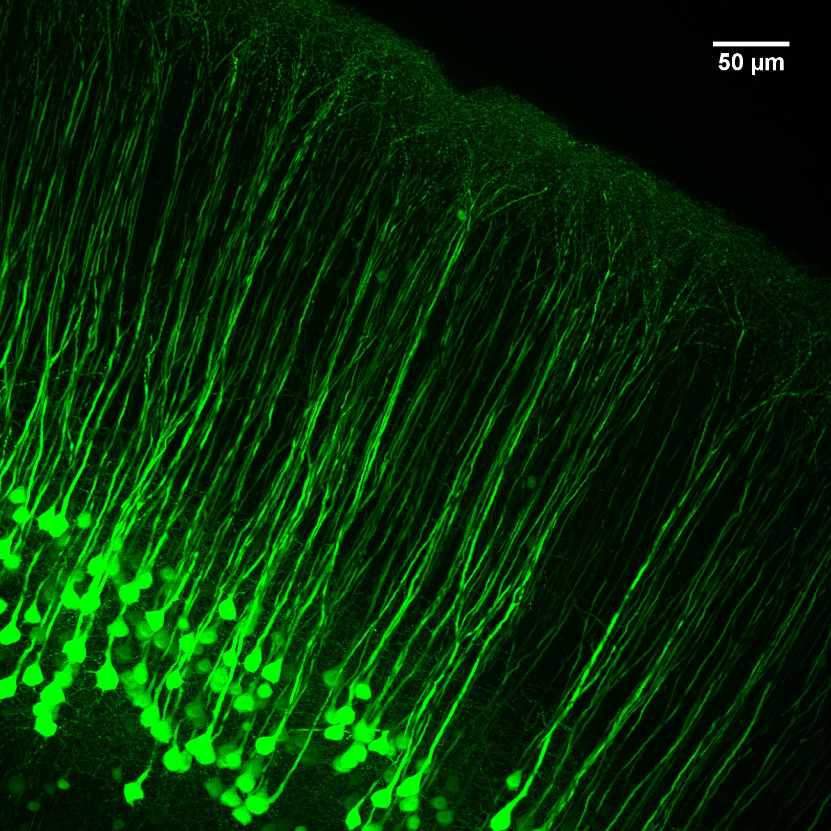 Green fluorescent protein (GFP) lights up the "neuron lights" in the ...