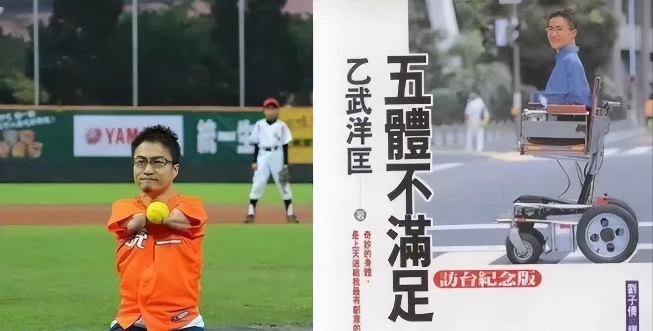 Ototake Yoko: Born without limbs, cheated on 50 people after 15 years ...