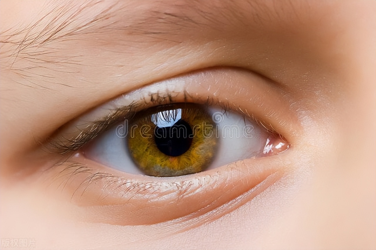 What are the common diseases of ciliary congestion? What symptoms will ...