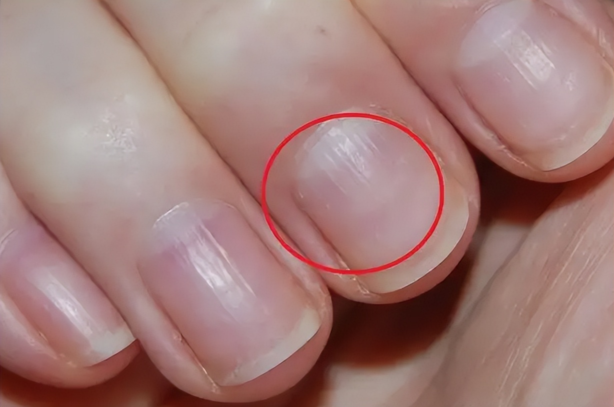 6 kinds of nail conditions are made public, understand physical ...