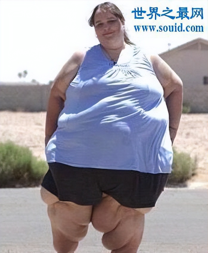 The fattest woman in the world weighs 1108 pounds!Once lost weight to ...