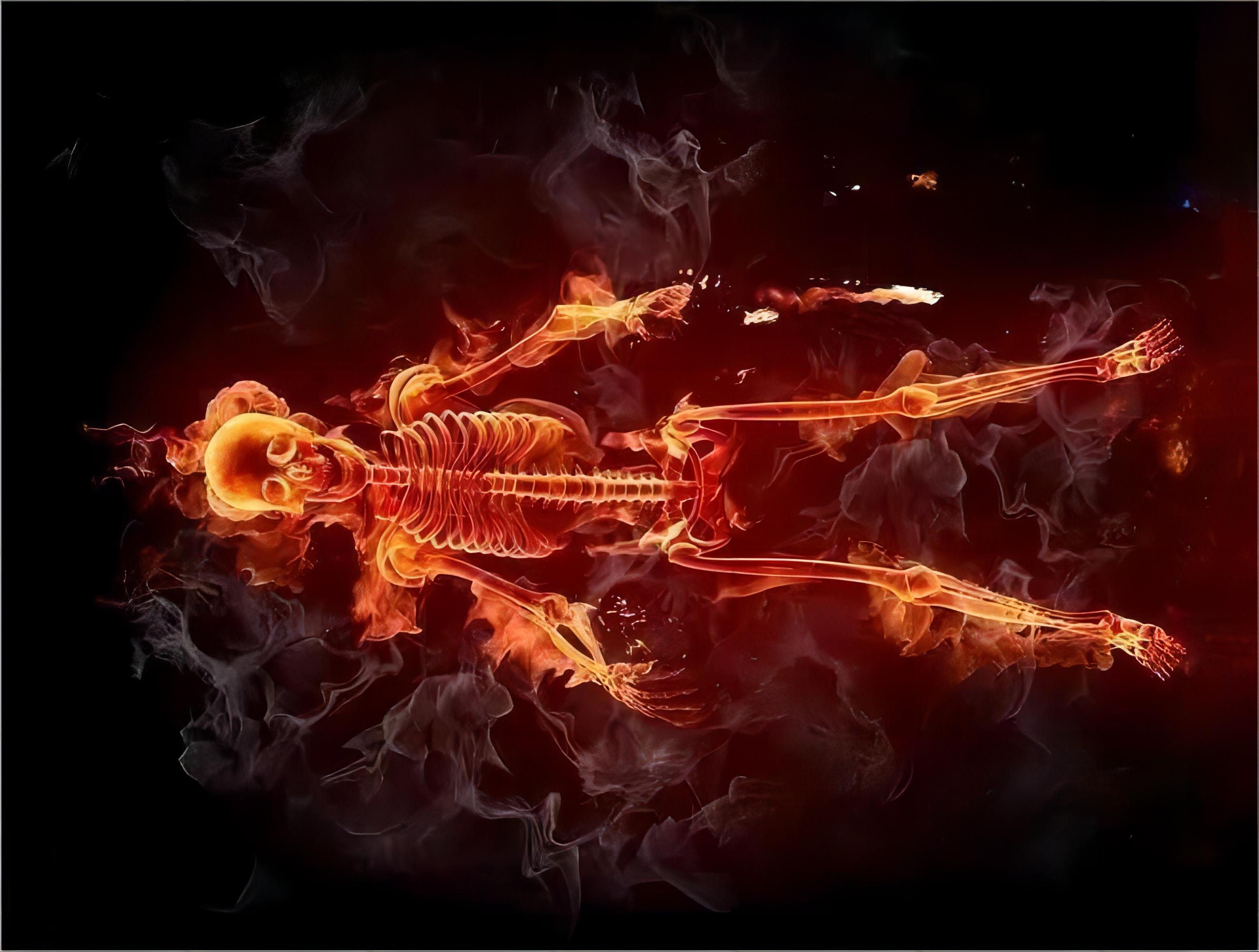 A New Solution to the Mystery of Human Spontaneous Combustion - iNEWS