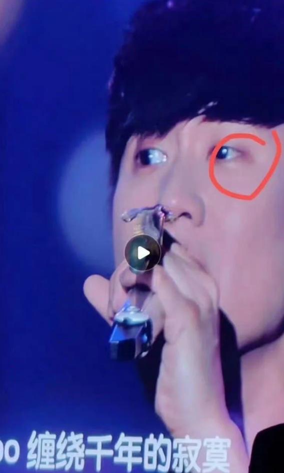 JJ Lin's concert was attacked by a laser pointer, and his right eye was ...