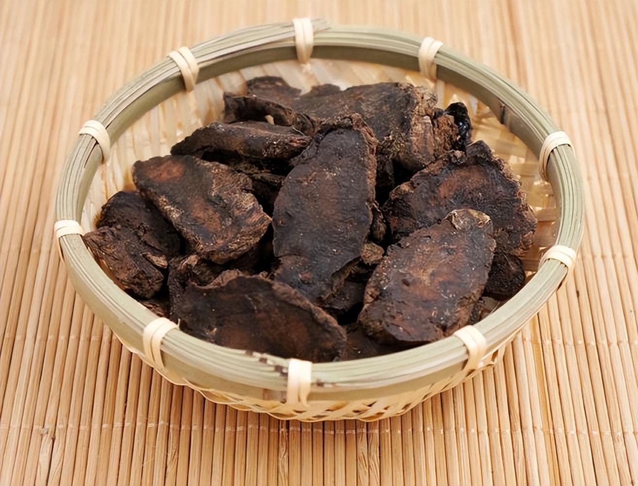 Acute urinary tract infection accompanied by hematuria, 1 commonly used ...