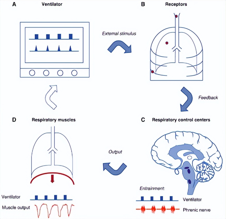 Professor Luo Hong: How to identify "reverse trigger" during mechanical ventilation and view its ...