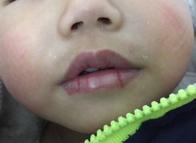 The child's lips were bleeding and bleeding, and he couldn't help ...