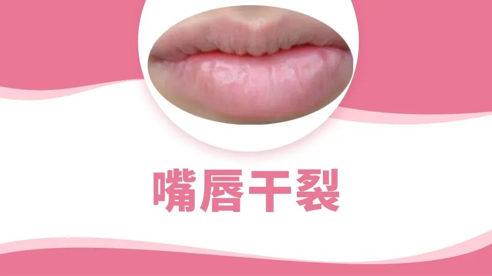 How does TCM "read" the body from the color of the lips?Teach you all ...