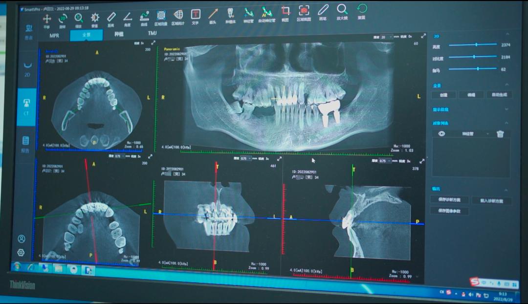 How do robots grow teeth?On-site direct attack on the whole process of ...
