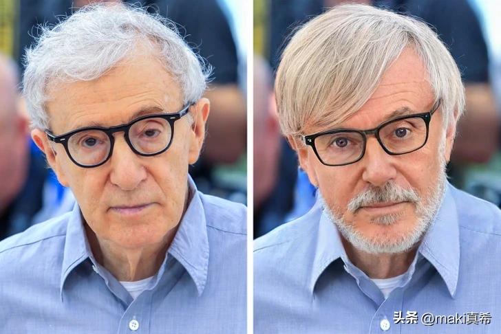 Mr. Bean has undergone plastic surgery to become a Hollywood face, and ...