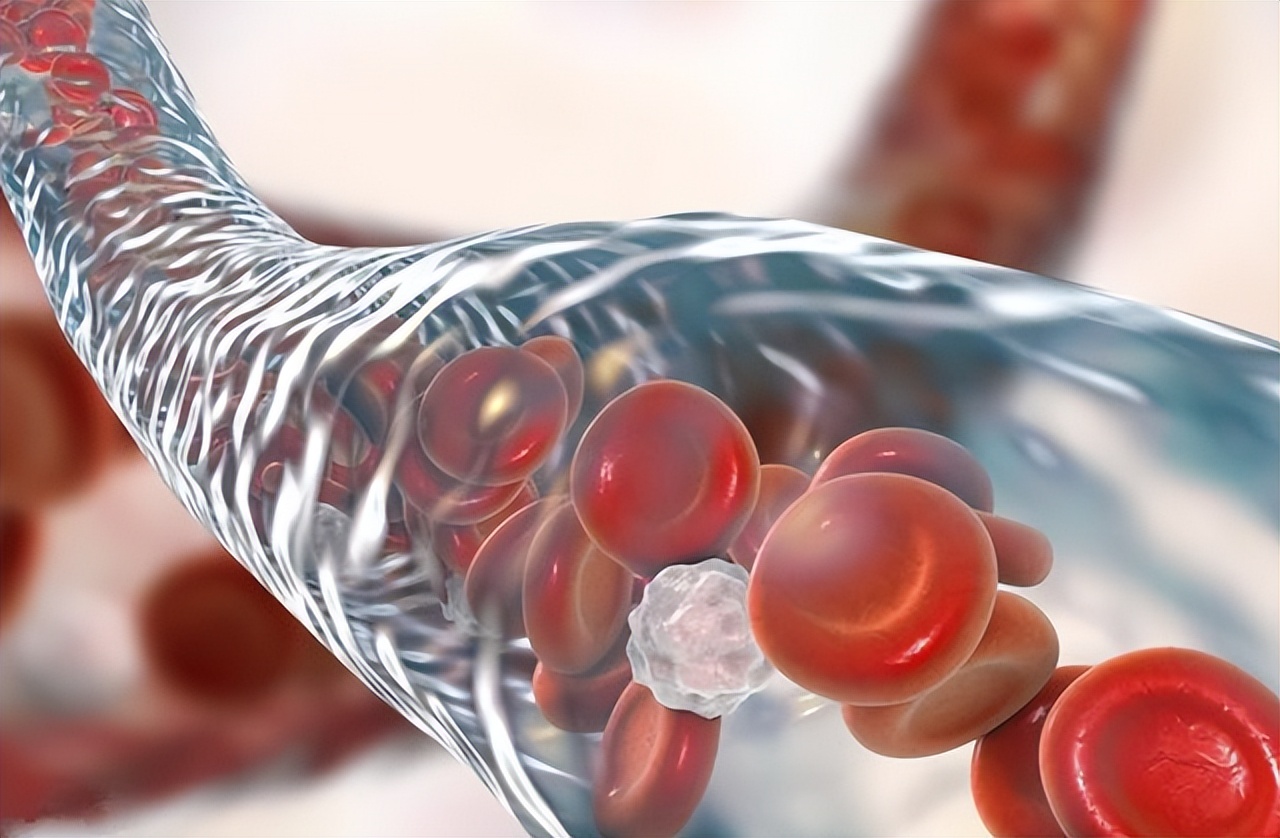 How to regulate blood viscosity?Doctor: Persist in doing 6 things well ...