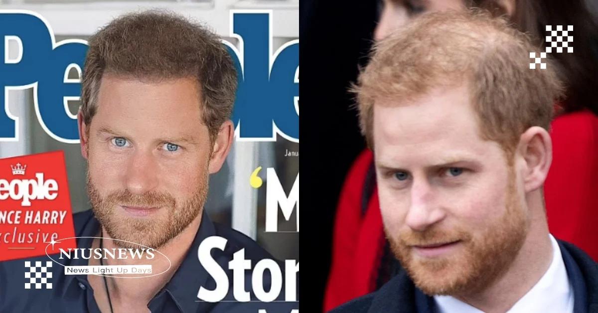 Prince Harry's hair volume surged and appeared on the cover ...
