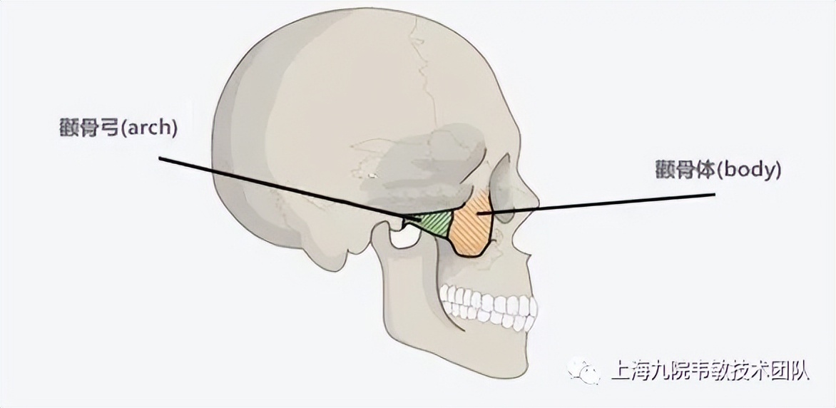 Does cheekbone push-in cause facial sagging? - iNEWS