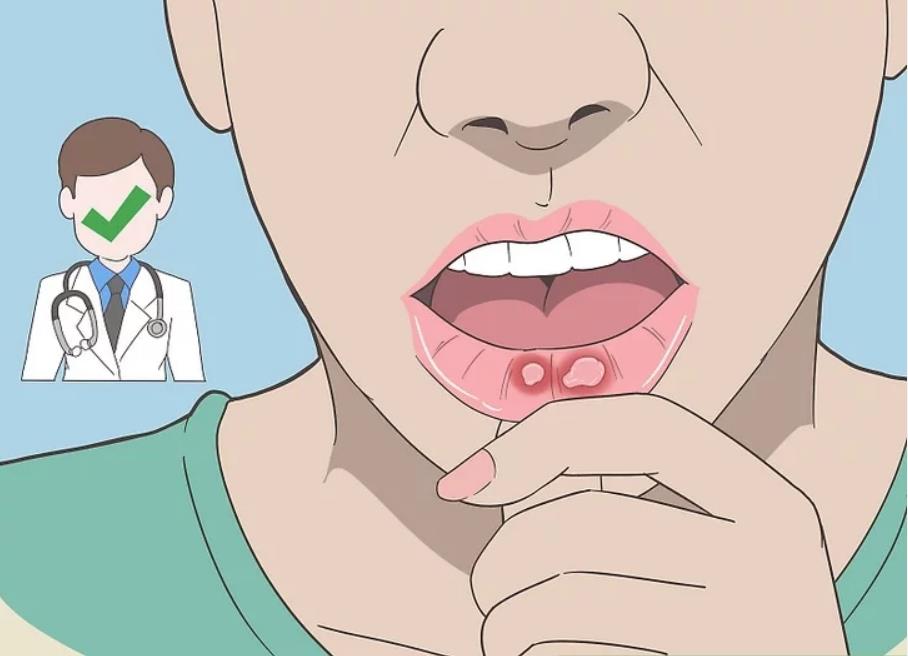 Can Tongue Kissing Cause Hiv Infection at Sam Kyle blog