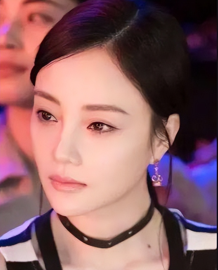 Li Xiaolu's eyelids were "sprayed" during plastic surgery, and there ...