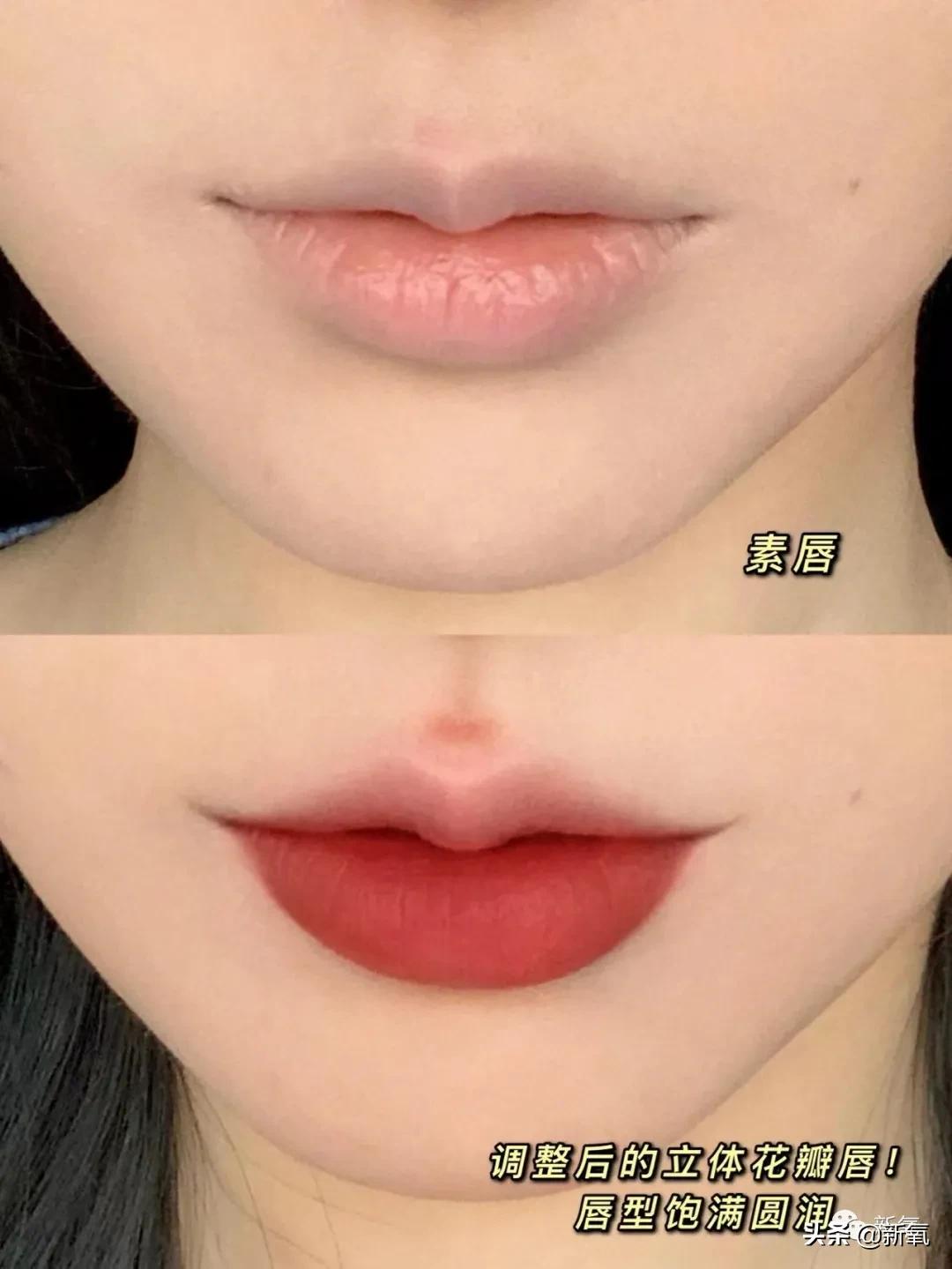 How much does the drooping corner of the mouth affect the face? - iNEWS