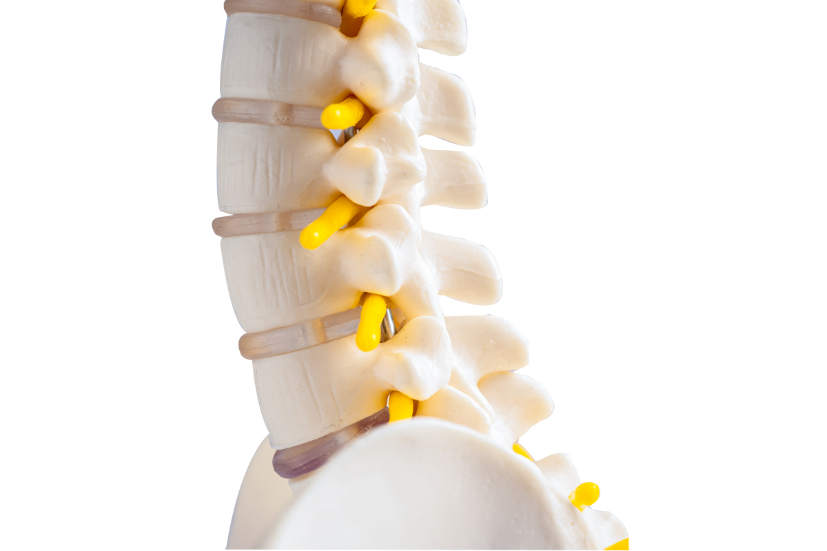 Instability of the lumbar spine is prone to injury and requires ...