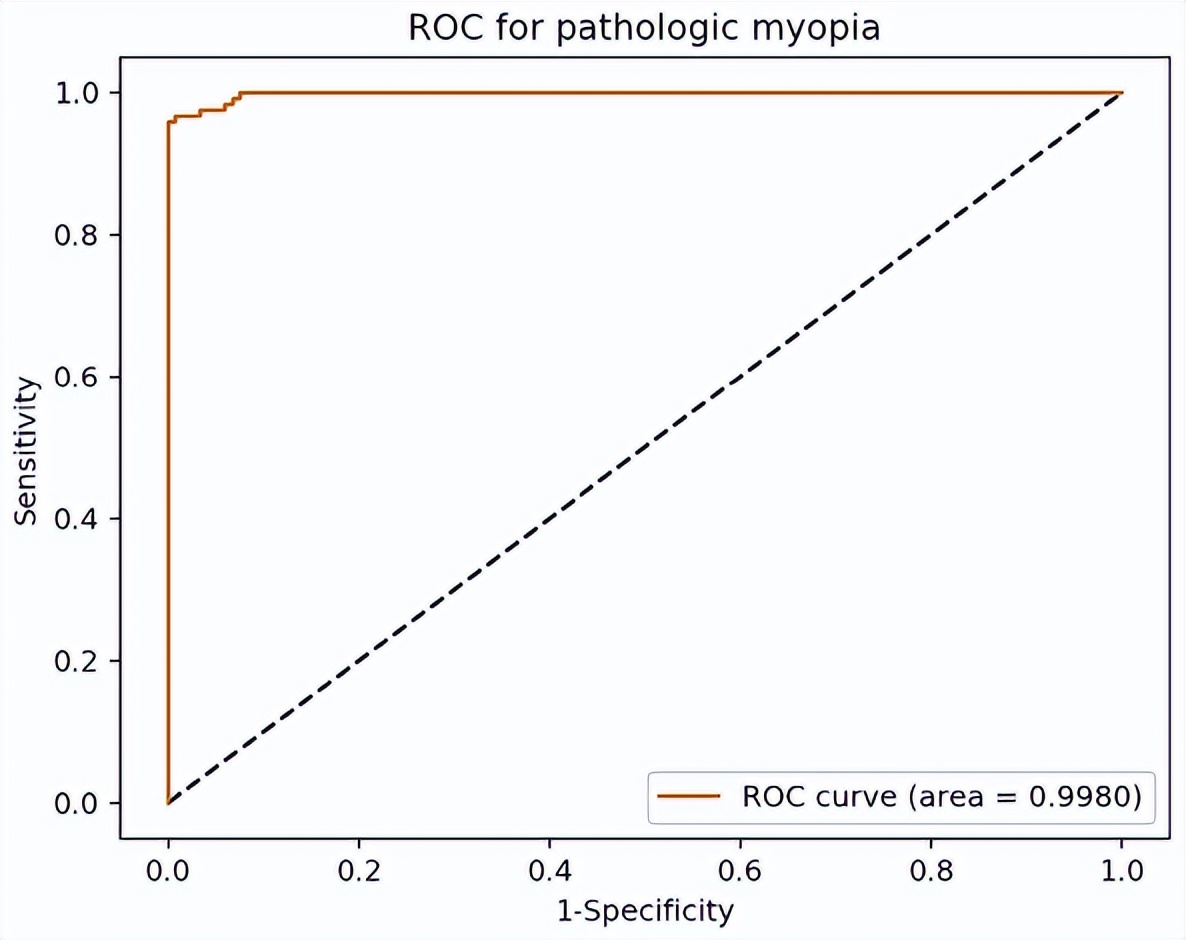 Myopic macular degeneration based on artificial intelligence - iNEWS