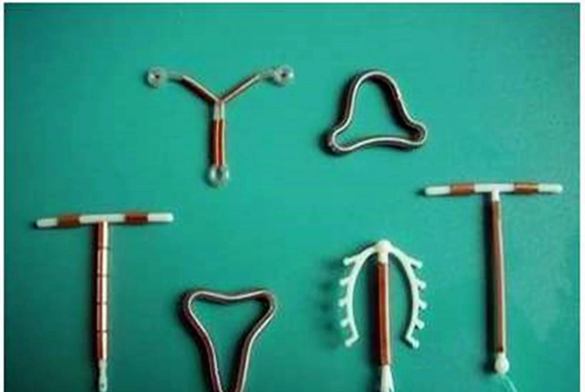 The IUD was expired and the woman almost ruptured the uterus. The ...