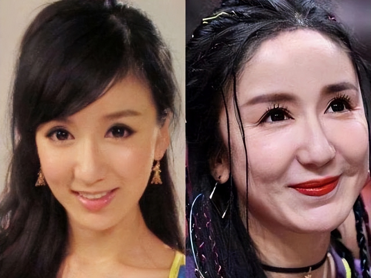 The faces of several celebrities with excessive plastic surgery are ...