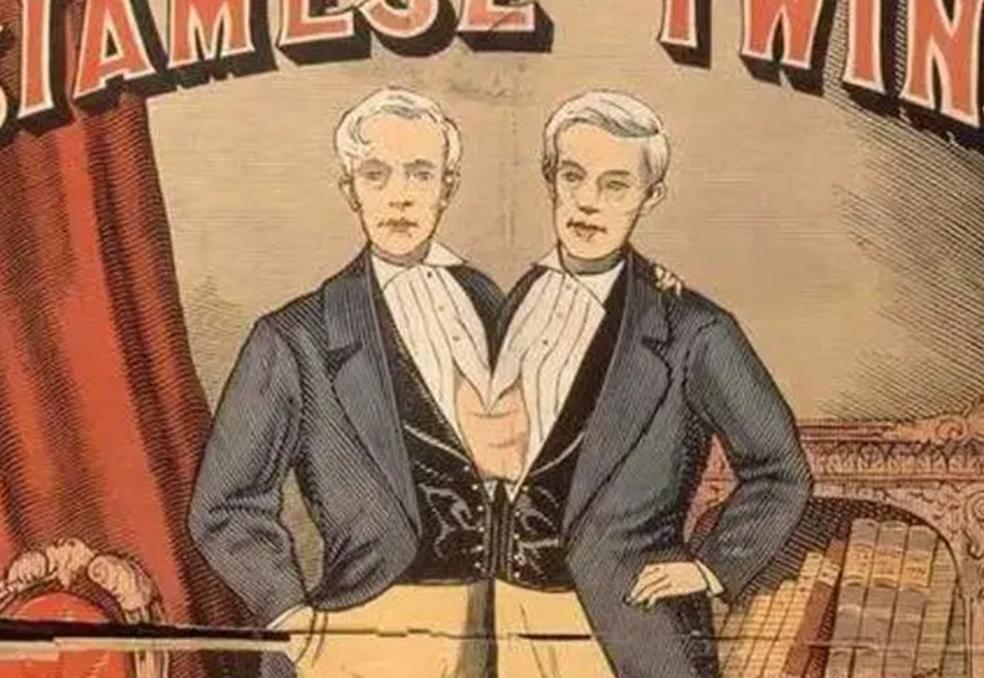 Siamese brothers in Thailand married their sisters and gave birth to 22 ...