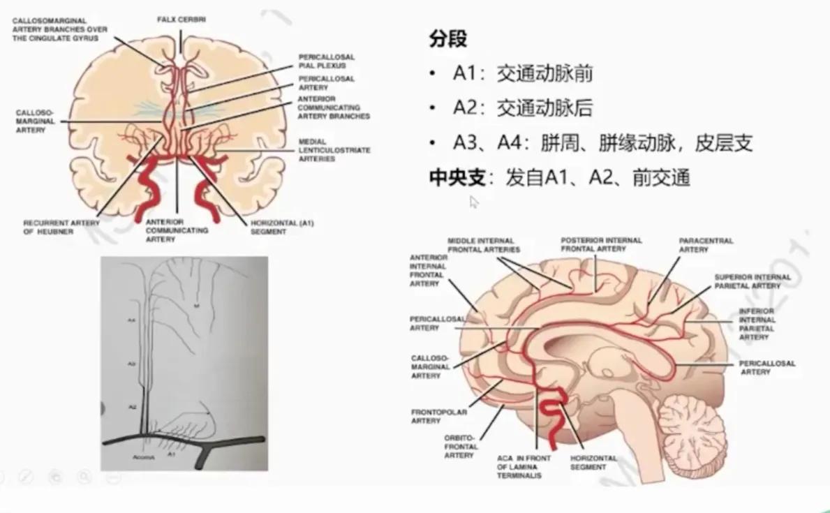 Imaging diagnosis of cerebrovascular disease - iNEWS