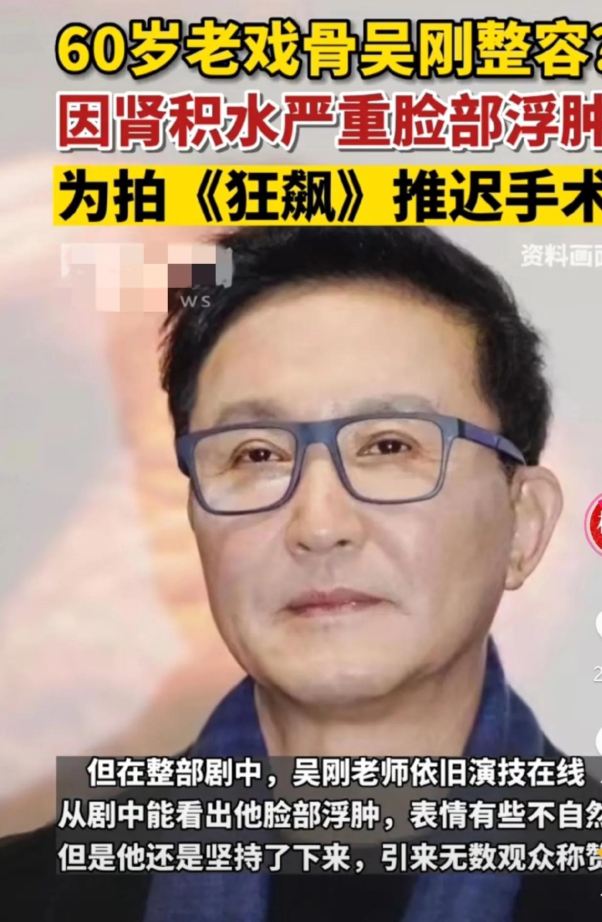 60-year-old actor Wu Gang has plastic surgery?Netizen: Because of ...