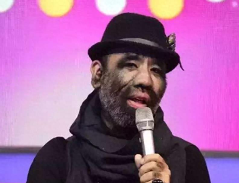 Once a nationally protected child, the furry kid became increasingly ...