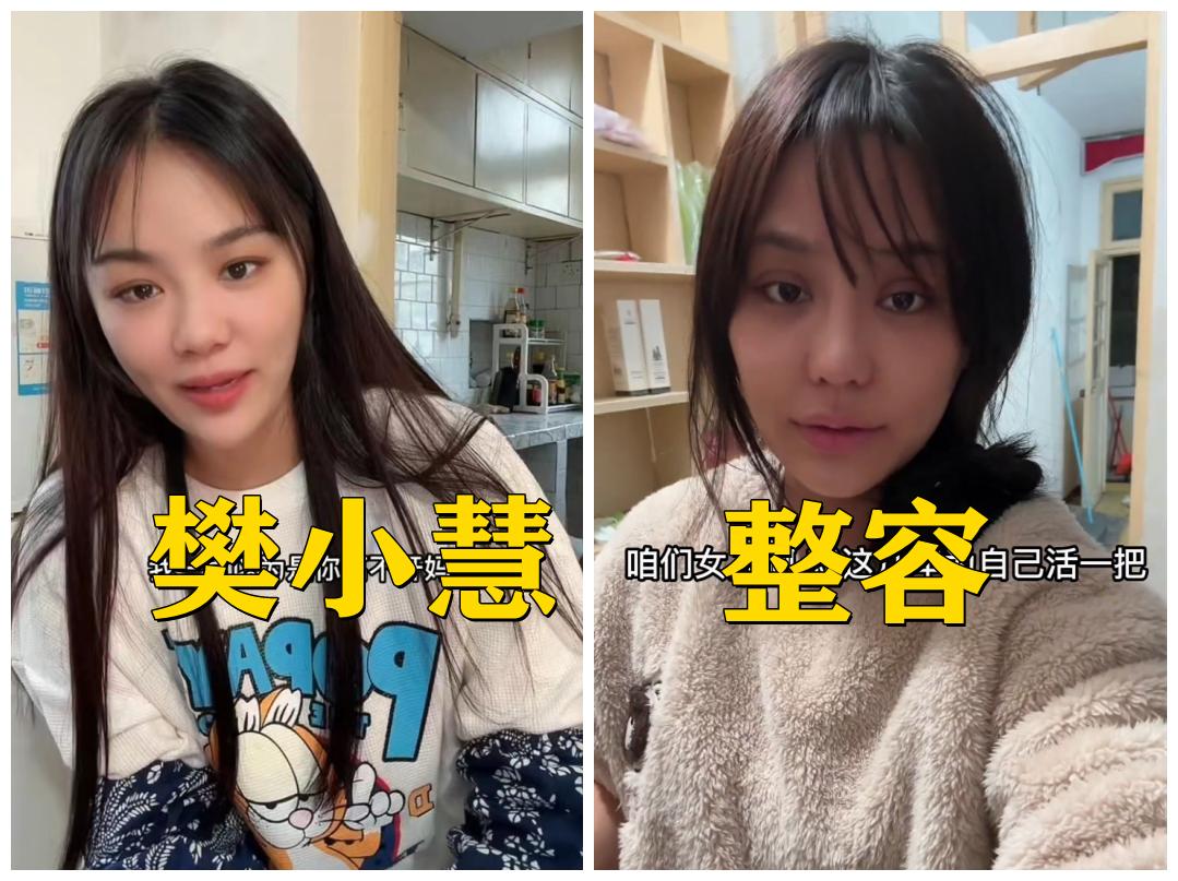 Fan Xiaohui returned after plastic surgery after the divorce turmoil ...
