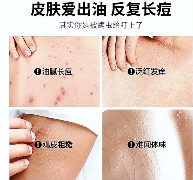 After bathing with "sulfur soap" for many years, what will happen to ...