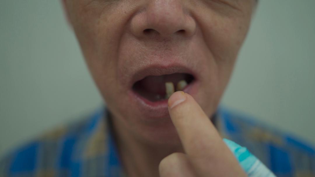 Uncle Mai with a mouthful of rotten teeth can bite anything after the ...