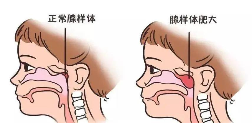 Short chin, small chin, 5 reasons that affect the proportion, which one ...