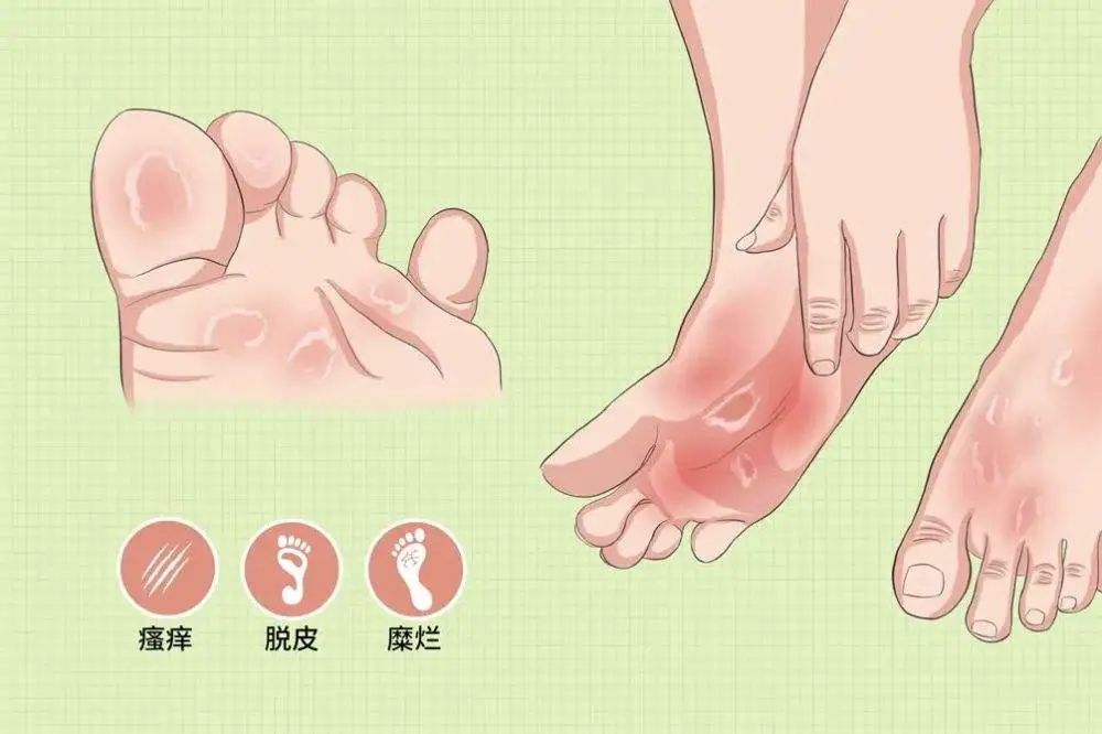 Types and treatment of beriberi - iNEWS