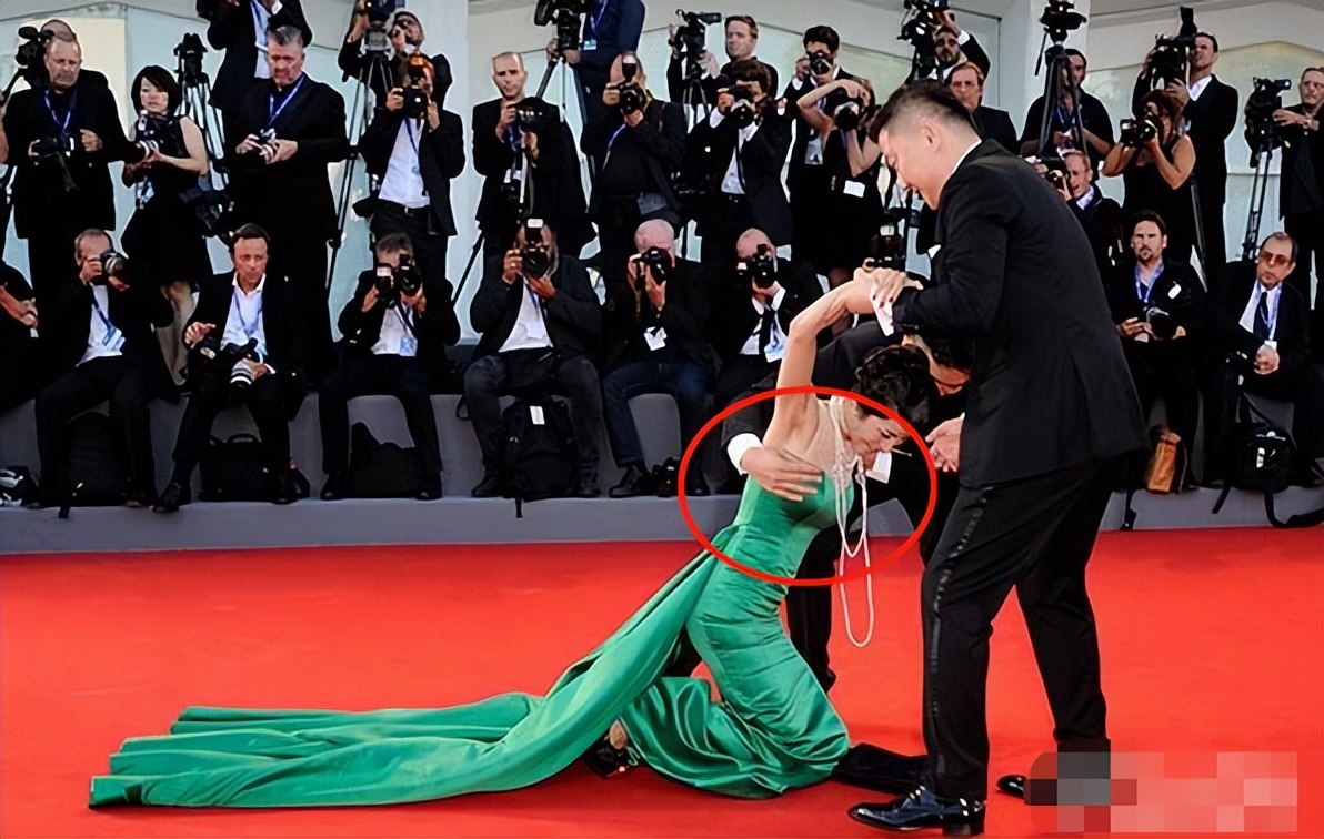 Clothes slipped, dizzy, fell, "deliberately exposed", counting the ...