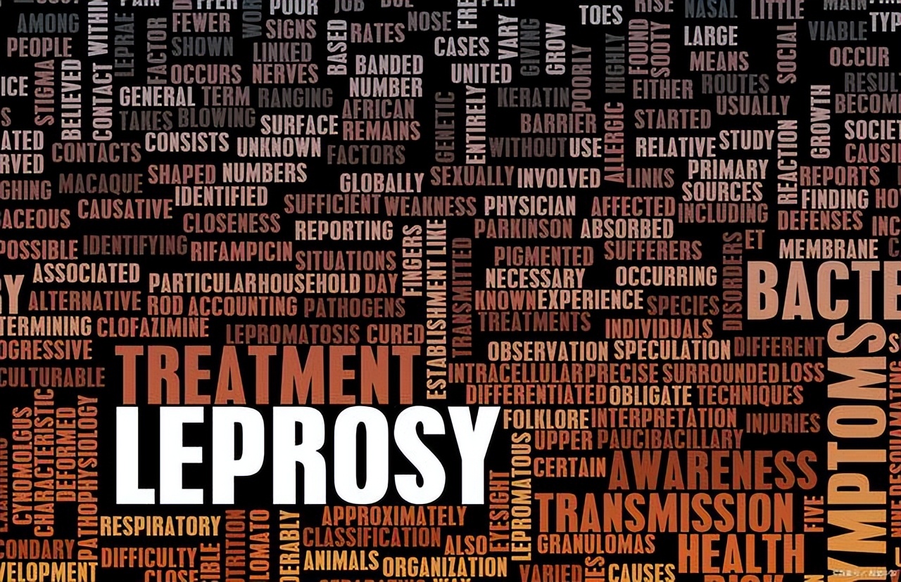 How much do you know about leprosy - iNEWS