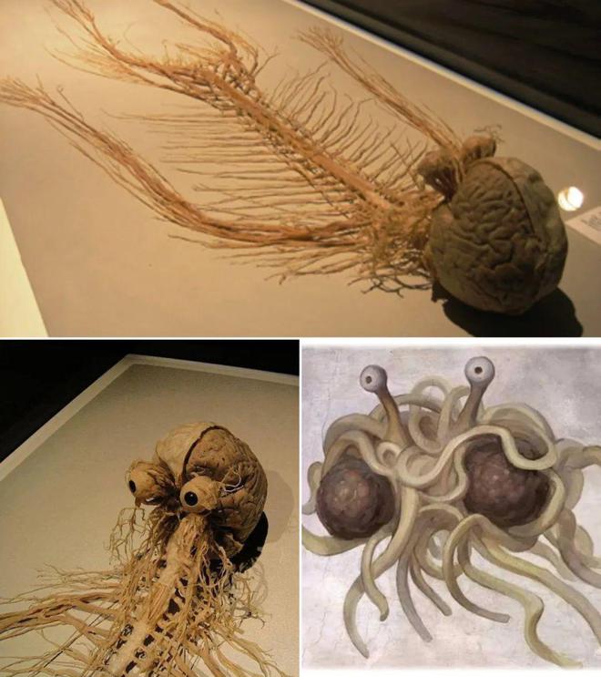The largest testicle, the complete nervous system of human beings, the ...