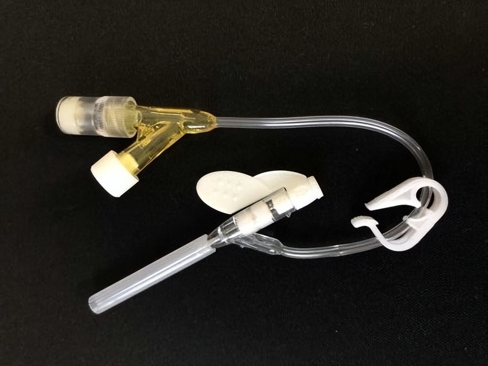 What is the "indwelling needle" used during infusion? - iNEWS