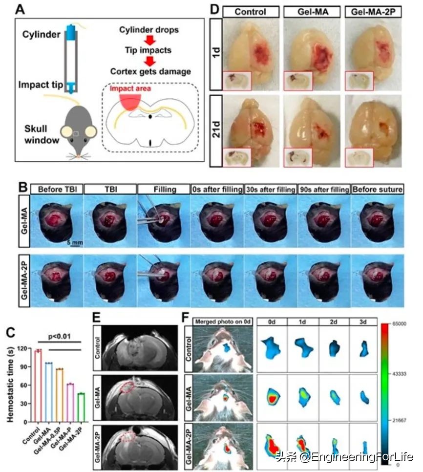 用於快速止血和組織再生的GelMA水凝膠，《AHM》+1 - 資訊咖
