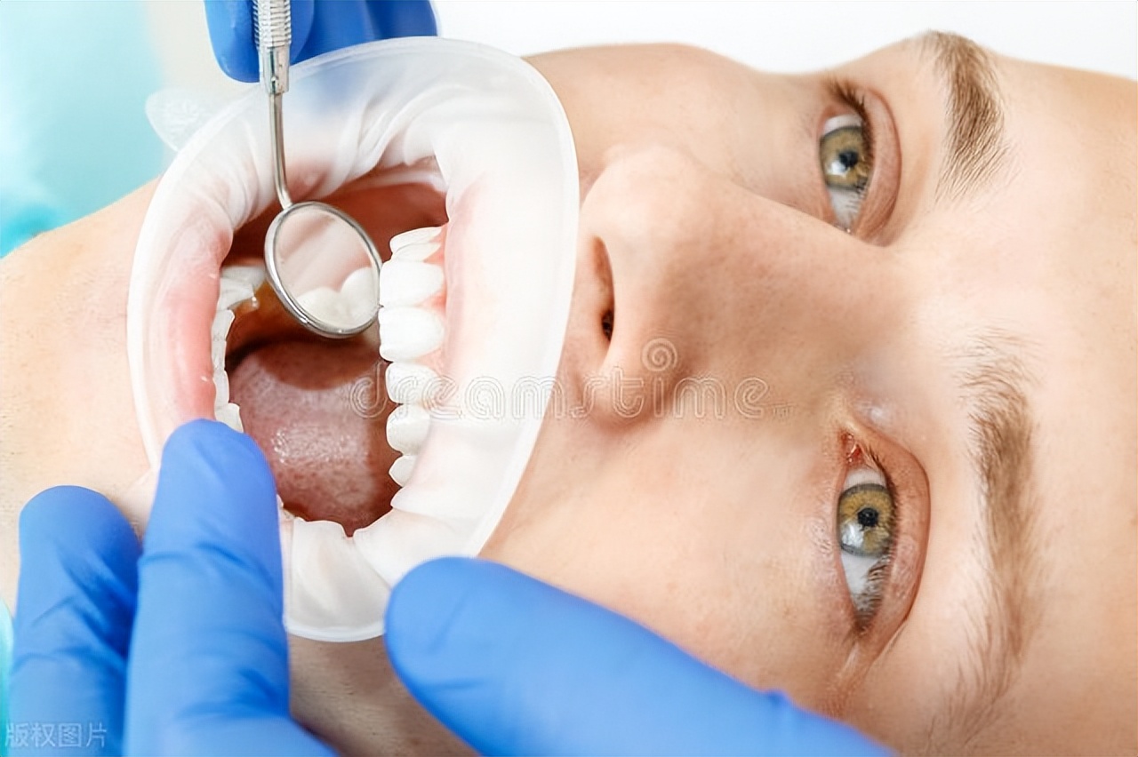 Pick your teeth and find soft, smelly yellow mud? What is it? You will ...