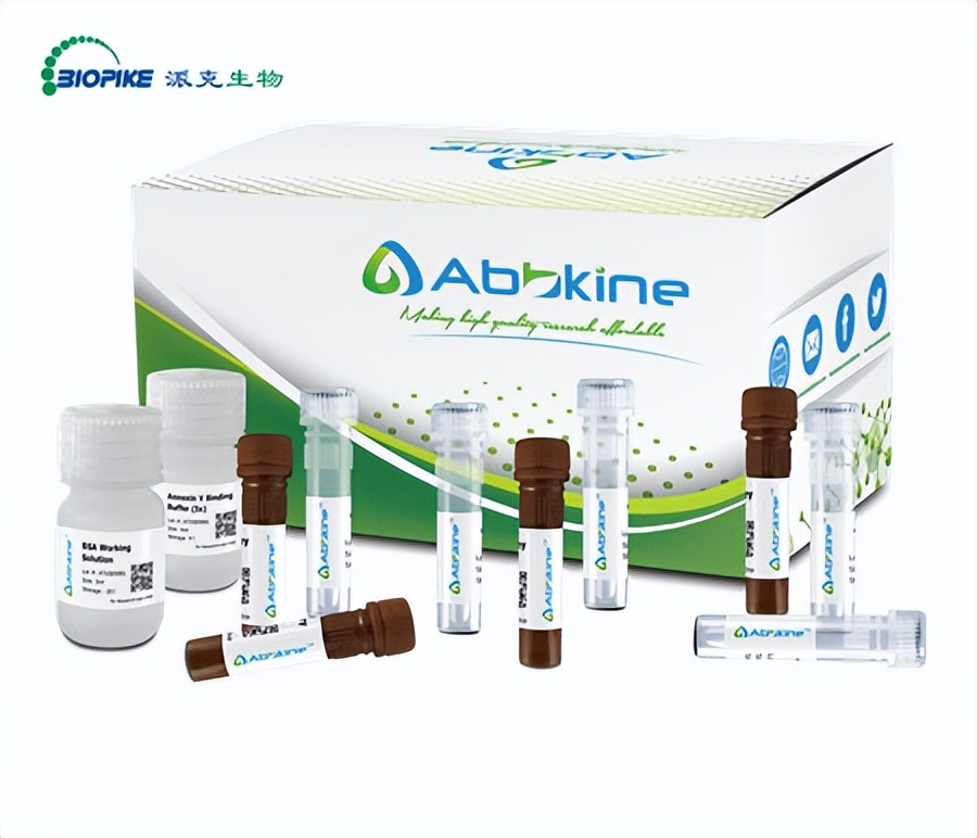 Parker Bio Abbkine Animal Cell or Tissue Total Protein Extraction Kit ...
