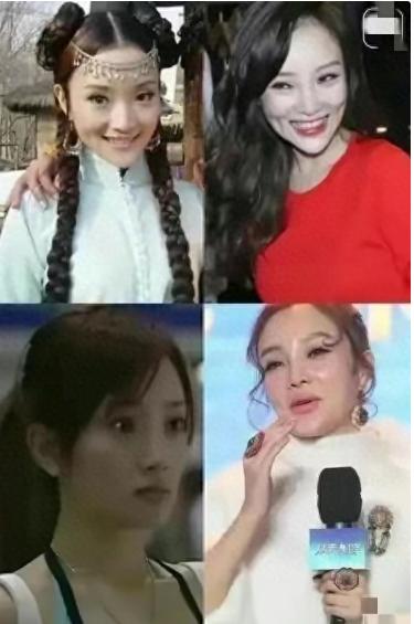 The top actresses who rely on "plastic surgery" have finally changed ...