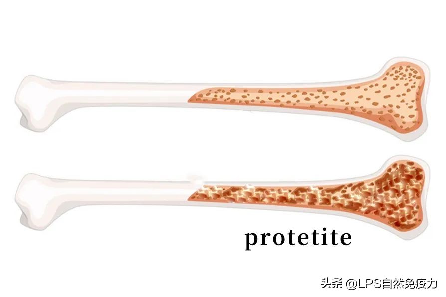 To keep your bones healthy, you must build up bone mass - iNEWS