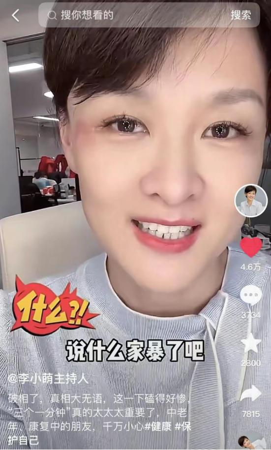 Recent CCTV photos of Li Xiaomeng are worrying!The corners of the eyes ...