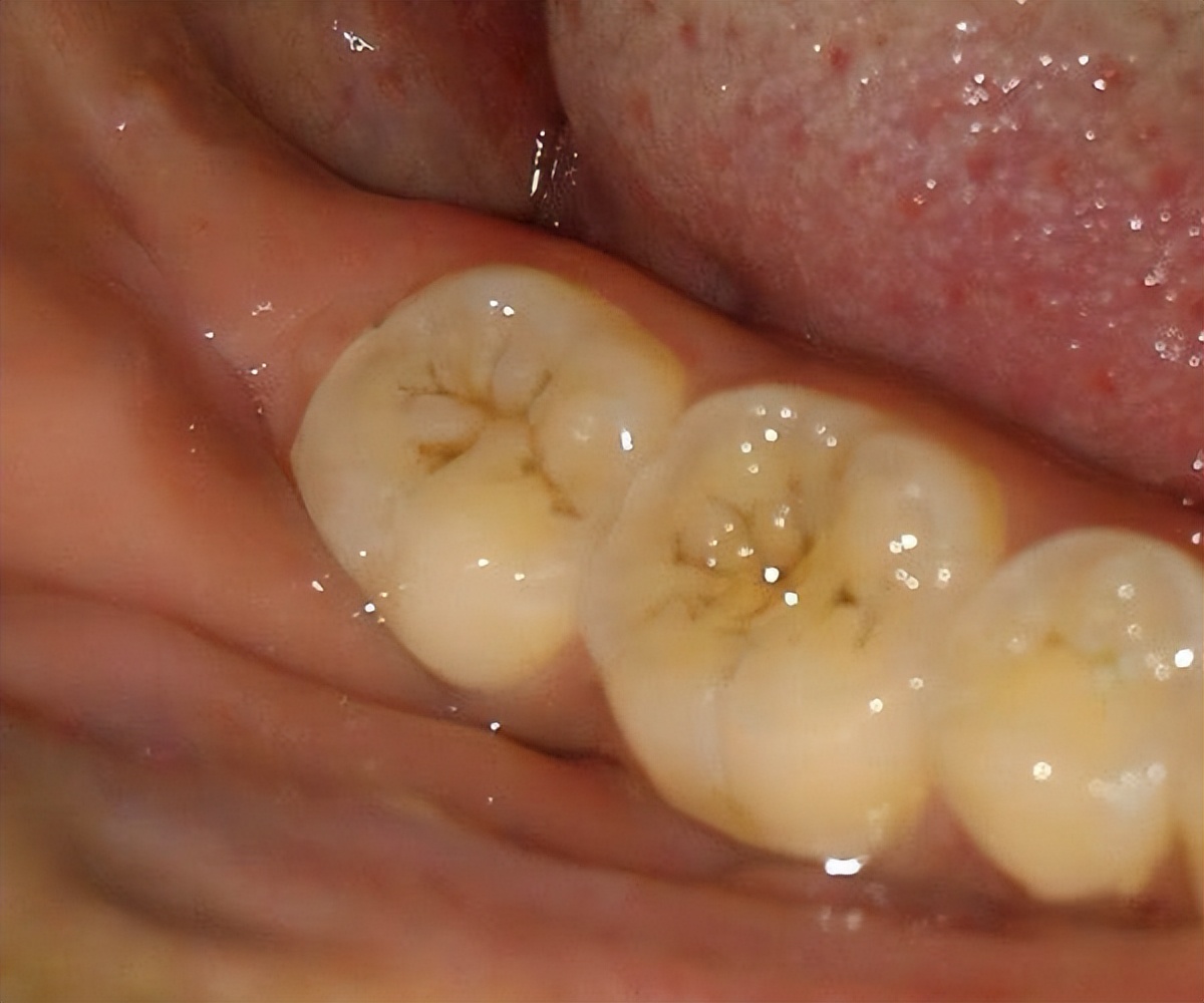 Why can't I smell something stinky from my teeth? - iNEWS