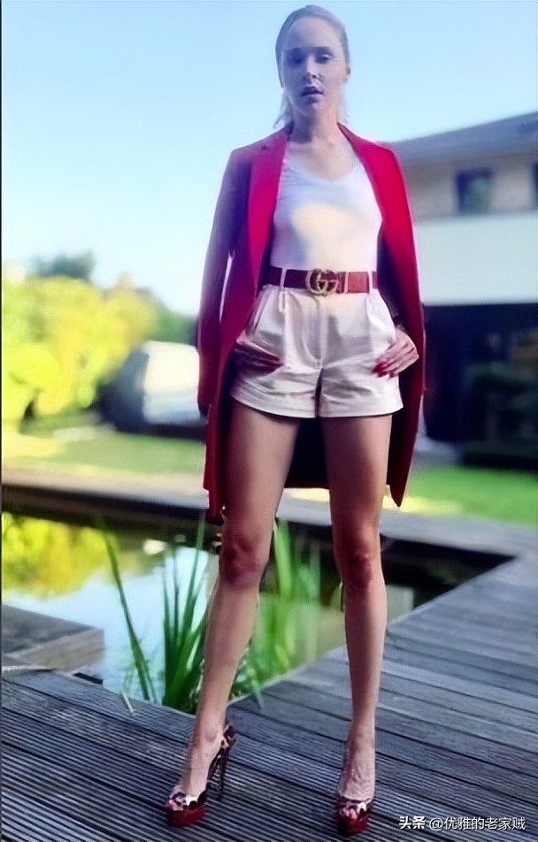 "My legs grew by 14 centimeters" German model in her 30s risked her ...