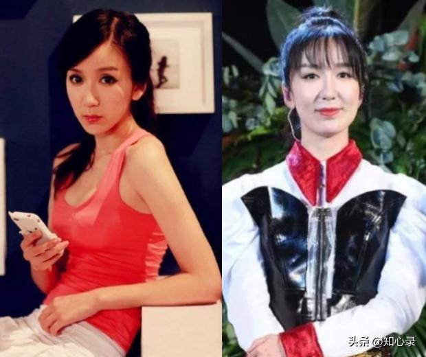 Don't use plastic surgery!Look at these short-lived actresses, they ...